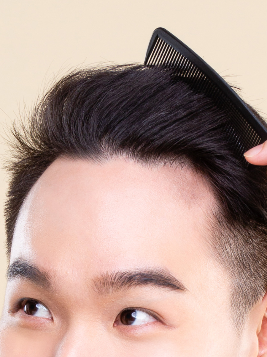The Mane Thing: Find Answers To Your Hair Loss Questions | AndSons SG