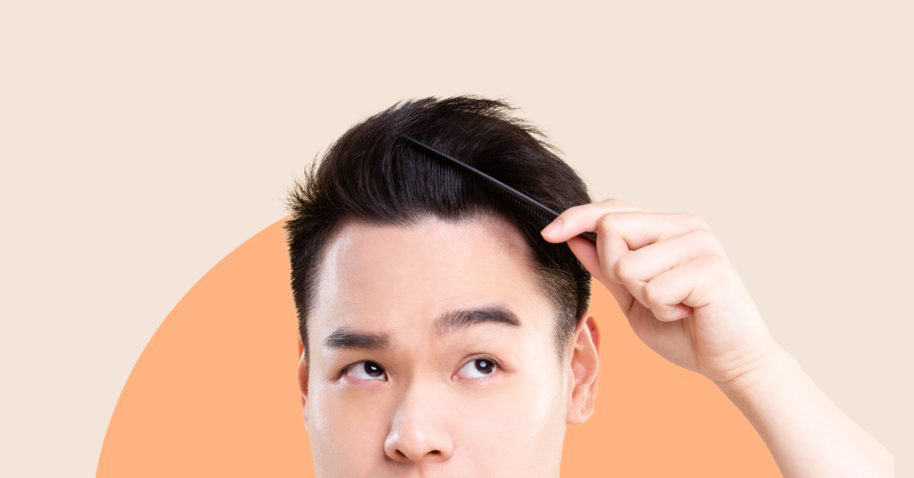 Hair Loss In Men - Types And Causes | AndSons SG